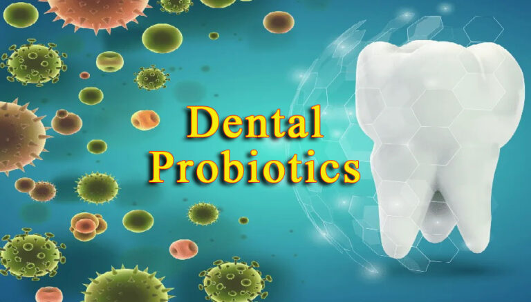 Dental Probiotics: The Ultimate Guide to a Healthy Smile